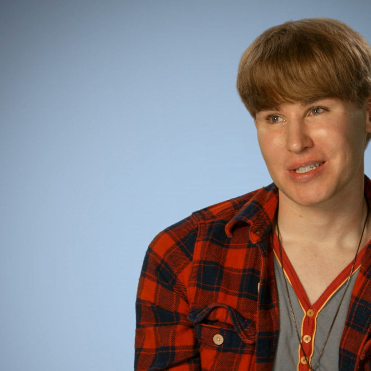Justin Bieber Look Alike Botched