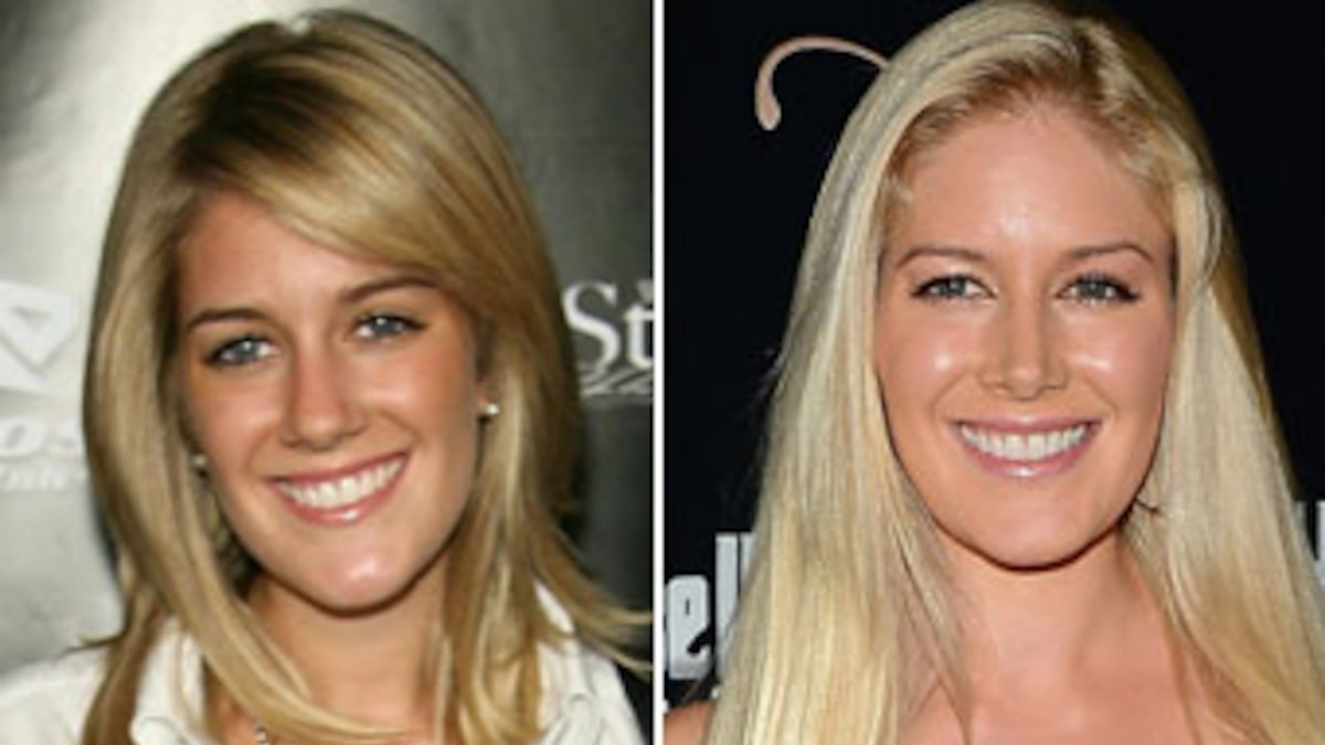 Celebrity Plastic Surgery