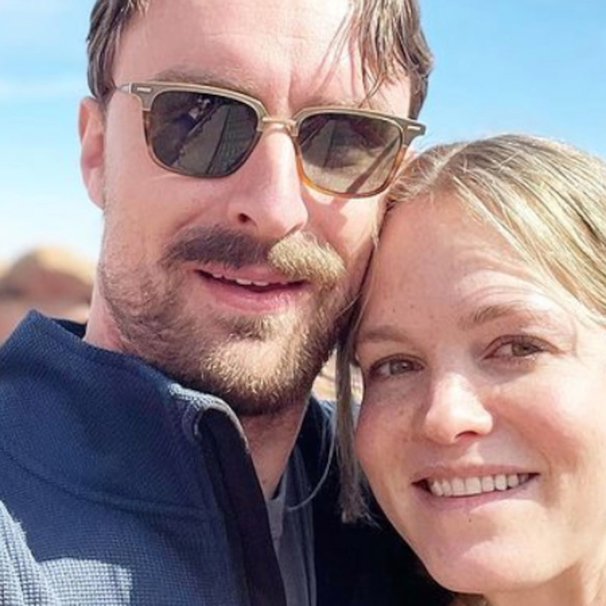 Erin Heatherton Nose Job Before And After