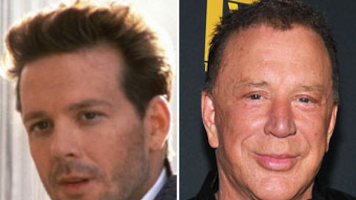 Celebrity Plastic Surgery