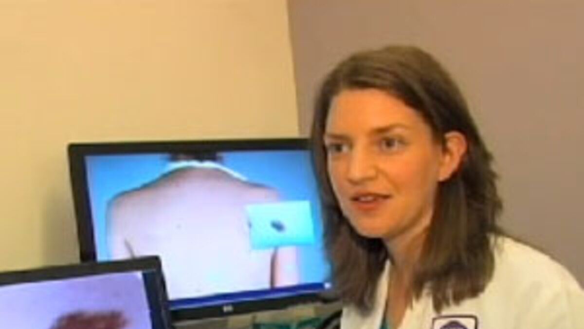 Skin Cancer Warning Signs